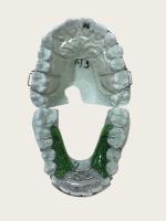 China Comfortable Fit Orthodontic Dental Lab Orthodontic Functional Appliances High Precision for sale