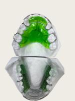 China Custom Crown And Bridge Dental Lab Precision Fit For Dental Clinics FDA Compliant for sale