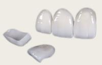 China Ivoclar Emax Laminate Veneers Translucent Esthetic Restorations Dental Clinic Veneers for sale