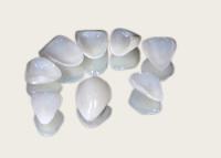 China Ivoclar Emax Laminate Veneers Translucent Esthetic Restorations Dental Clinic Veneers for sale