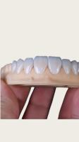 China Dedicated Dental Laboratory Laminates And Veneers Customized Esthetic Restorations for sale