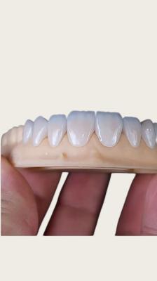 China Dedicated Dental Laboratory Laminates And Veneers Customized Esthetic Restorations for sale