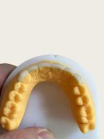 China Customized Dental Laminates And Veneers Long Lasting Dental Teeth Veneers for sale