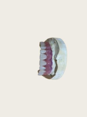 China High Precision Implant Supported Dentures Ivoclar Ball Attachments Natural Appearance for sale