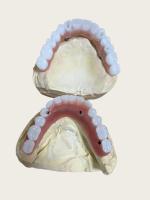 China Snap In Implant Supported Dentures Natural Looking Full Arch Implant Solutions for sale