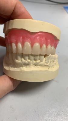 China Precise Flexible Partial Dentures Clear Metal Partial Denture Frameworks for Esthetic for sale
