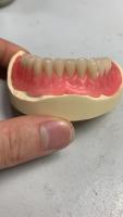 China Precise Flexible Partial Dentures Clear Metal Partial Denture Frameworks for Esthetic for sale