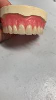 China Precise Flexible Partial Dentures Clear Metal Partial Denture Frameworks for Esthetic for sale