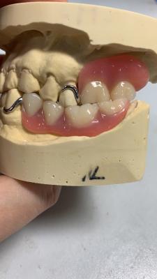 China Customizable Removable Dentures 3Shape Exocad Alloy Metal Partial Denture Framework for sale