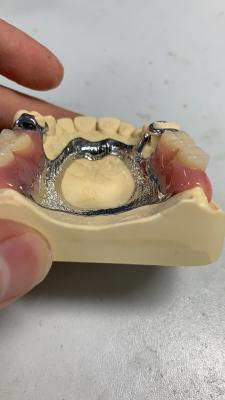 China Acrylic Dental Prosthesis Easy Clean Removable Dentures For Optimal Comfort for sale