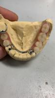China Acrylic Dental Prosthesis Easy Clean Removable Dentures For Optimal Comfort for sale
