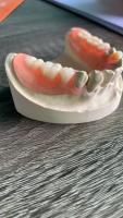 China Natural Looking Ivoclar Dental Acrylic Denture Teeth Full Arch Restorations Long Lasting for sale