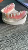 China Natural Looking Ivoclar Dental Acrylic Denture Teeth Full Arch Restorations Long Lasting for sale
