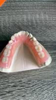 China Natural Looking Ivoclar Dental Acrylic Denture Teeth Full Arch Restorations Long Lasting for sale