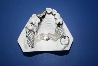 China Lightweight Titanium Dental Framework High Precision Partial Removable Dentures for sale