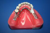 China Temporary Full Acrylic Dentures CAD CAM Restorations Wear Resistance FDA Approved for sale
