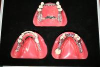 China Temporary Full Acrylic Dentures CAD CAM Restorations Wear Resistance FDA Approved for sale