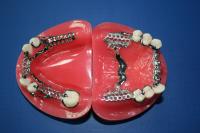 China Temporary Full Acrylic Dentures CAD CAM Restorations Wear Resistance FDA Approved for sale