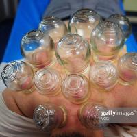 China Thick Non-Slip Bottle Bottom Glass Vacuum Cupping Set for Chinese Hijama and Massage for sale