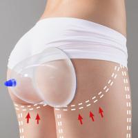 China Enlarging Breast Cupping 13.5cm 2 Pieces for Female Massager T01 Inner Diameter 110±2mm for sale