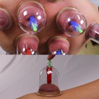 China Household Cupping Therapy Set of 6 for Vacuum Massage and Acupuncture for sale