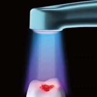 China 7 Tips Root Canal Wireless Blue-Violet With Dental Oral Led Curing Light Equipment for sale