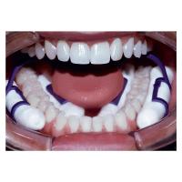 China Dental Cotton Roll Good Quality Disposable Dental Cotton Roll for sale