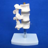 China Advanced PVC Educational Models Cutaway Osteoporosis of Spine Lesions of Lumbar Vertebra for sale