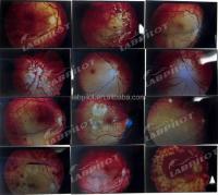 China Manikin for Advanced Human Eye Examination Training Simulator Retinopathy Fundus Model for sale