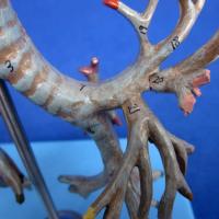China Vivid Anatomical Bronchial Tree Model 26 Positions Marked Trachea Anatomy for Medical Science for sale