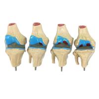China Anatomical demonstration of Human Knee Joint Pathology Model for Medical Science for sale