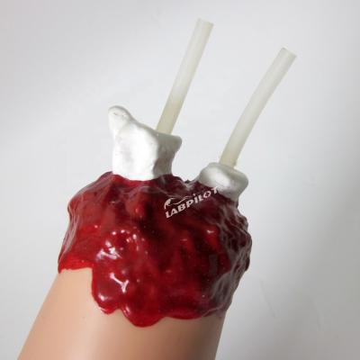 China Trauma Nursing Care Model Arm Amputation and Hemostasis for Upper Limb Wound Treatment for sale