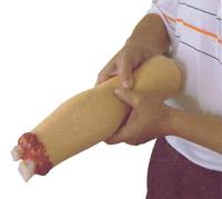 China Medical Science Trauma Care Simulator Bleeding and Amputated Arm Model for sale