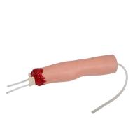 China Trauma Nursing Care Model Arm Amputation and Hemostasis for Upper Limb Wound Treatment for sale