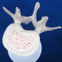 China Vivid Vertebra Models for Medical Science Atlas Axis Cervical Thoracic and Lumbar for sale