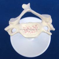 China Vivid Vertebra Models for Medical Science Atlas Axis Cervical Thoracic and Lumbar for sale
