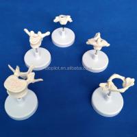 China Vivid Vertebra Models for Medical Science Atlas Axis Cervical Thoracic and Lumbar for sale