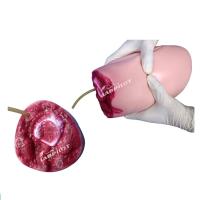 China Advanced PVC Model The Ideal Solution for Lower Limb Trauma Thigh Amputation Nursing for sale