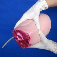 China Advanced PVC Model The Ideal Solution for Lower Limb Trauma Thigh Amputation Nursing for sale