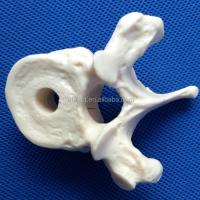 China Vivid Vertebra Models for Medical Science Cervical Thoracic Lumbar Sacrum and Coccyx for sale