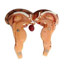 China Amplified Brainstem Model The Must-Have for Schools' Medical Anatomical Demonstration for sale