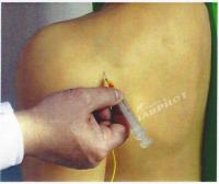 China Advanced PVC Medical Training Shoulder Joint Intracavitary Injection Simulator Teaching Model for sale