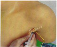 China Advanced PVC Medical Training Shoulder Joint Intracavitary Injection Simulator Teaching Model for sale