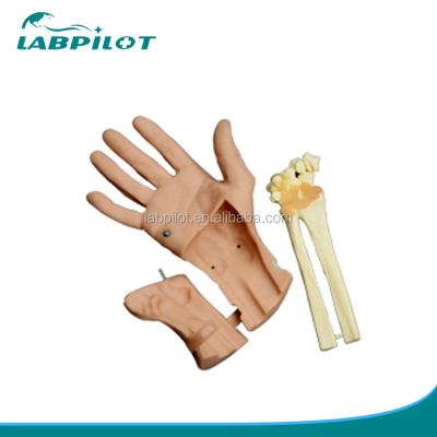 China Advantageous Advanced Wrist Arthroscopy Model for Vivid Anatomical Structure of Wrist for sale