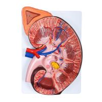 China Detachable Anatomical Kidney Model for Medical Demonstrations in Hospitals and Clinics for sale