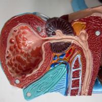 China Anatomical Model for Clinics 5 Parts Male Genital Organs Internal and External for sale