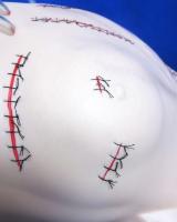 China Subject Medical Science Advanced PVC Surgical Wound Care Manikin for Nursing Education for sale