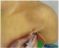 China Subject Medical Science Manikin Electronic Shoulder Joint Injection Training Simulator Nursing Model for sale