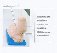 China Vivid Shoulder Joint Anatomy Training Model with Detachable Shoulder Arthroscopy Simulator for sale