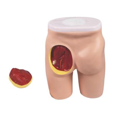 China Comprehensive IM Injection Teaching Model for Gluteal Muscles and Anatomy Education for sale